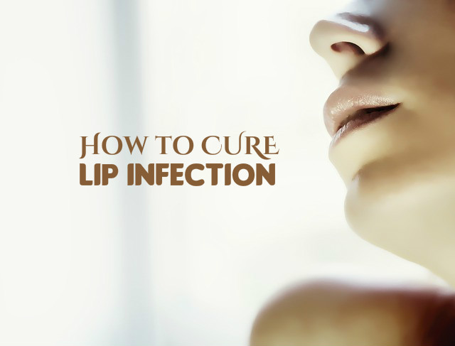 How To Heal A Lip Infection Naturally At Home