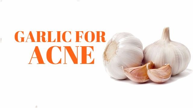 Best Home Remedies Using Garlic for Acne Treatment