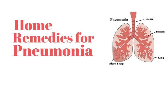 Best Home Remedies for Pneumonia That Really Cure