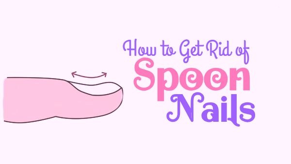 How to Get Rid of koilonychias/Spoon Nails with Remedies