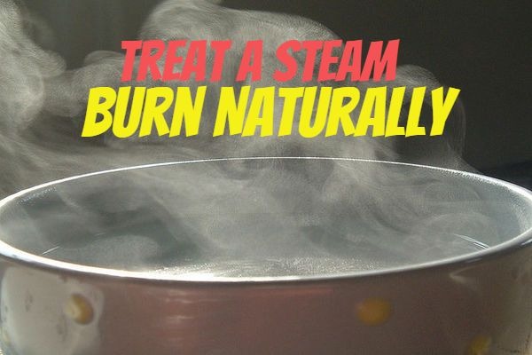 How To Treat a Steam Burn Easily (Best Natural Methods)