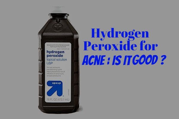 Hydrogen Peroxide For Acne Treatment- Is It Safe to Use